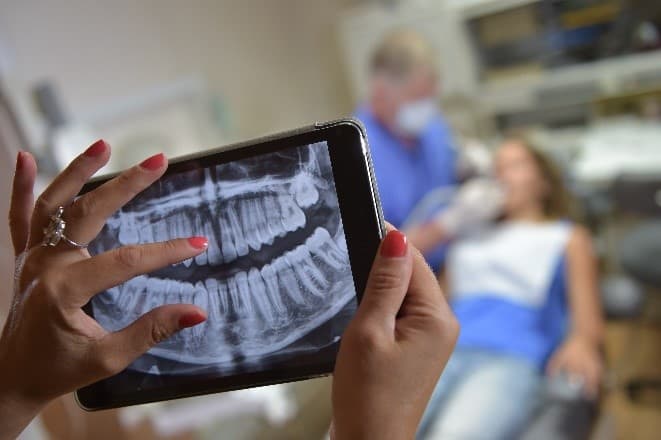 Dental Digital Imaging West Orange - Dental X-Ray Livingston
