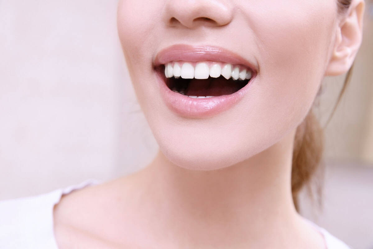 The Best Cosmetic Fixes for Common Smile Concerns